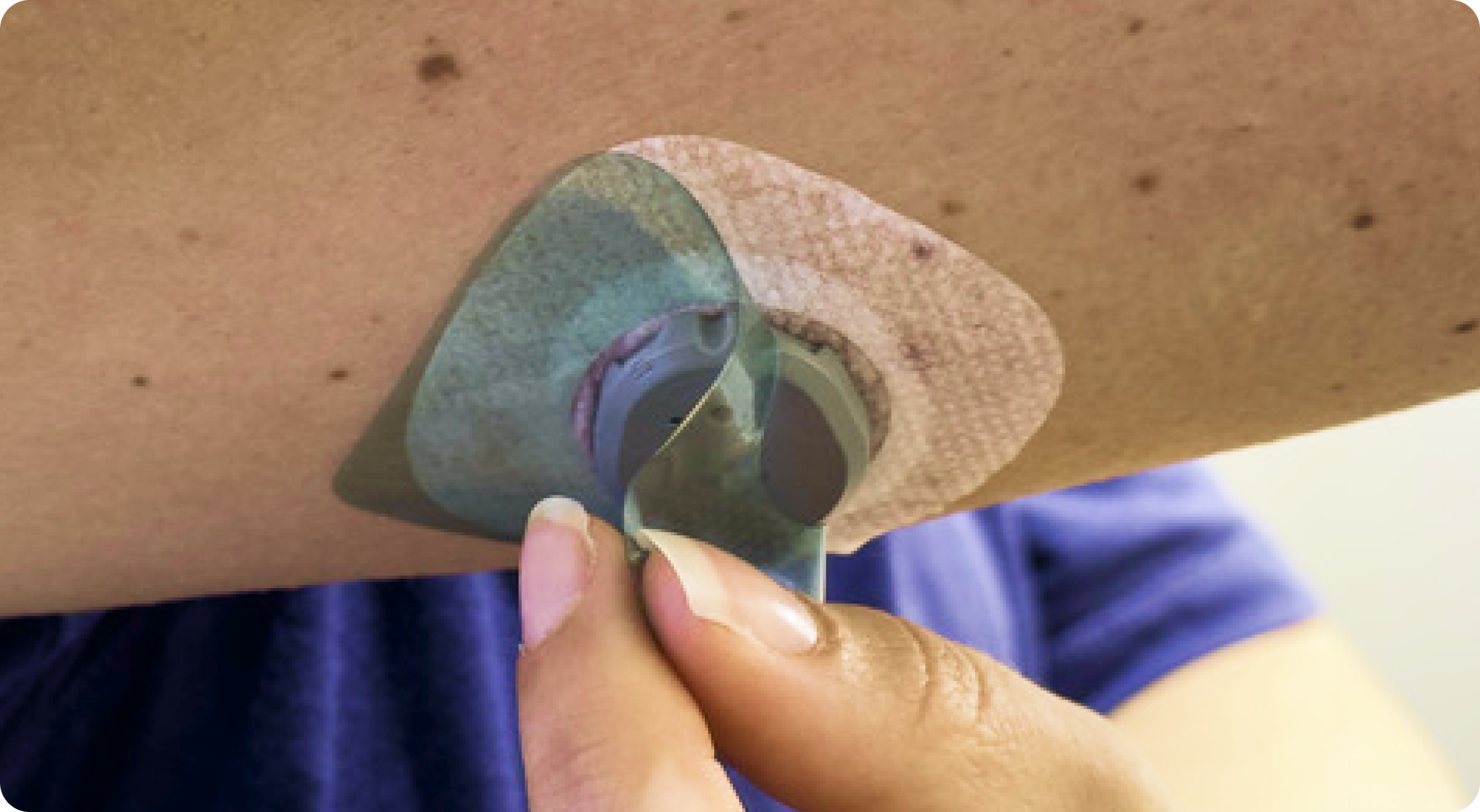 How to apply your Stelo Biosensor – Help Center