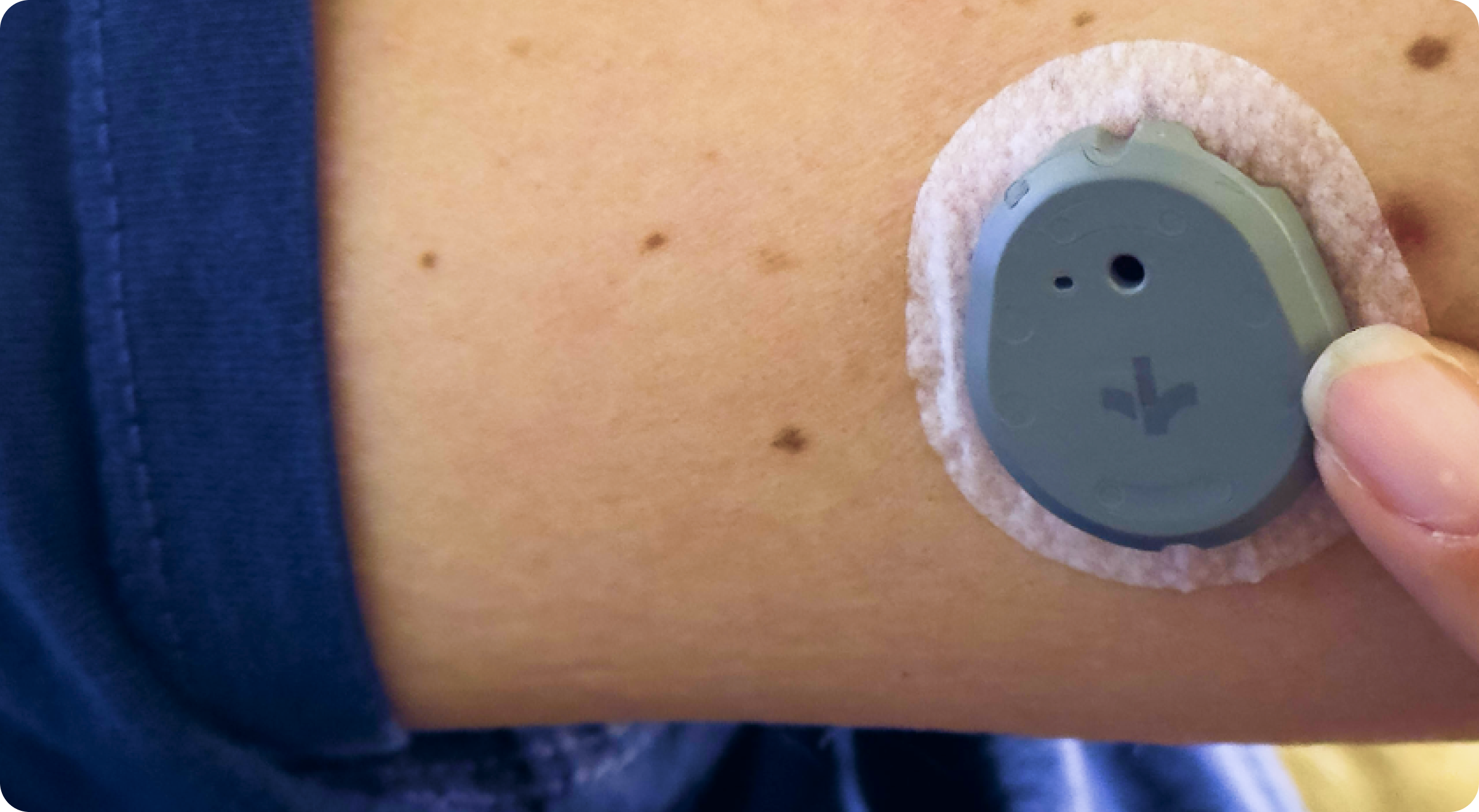 How to apply your Stelo Biosensor – Help Center